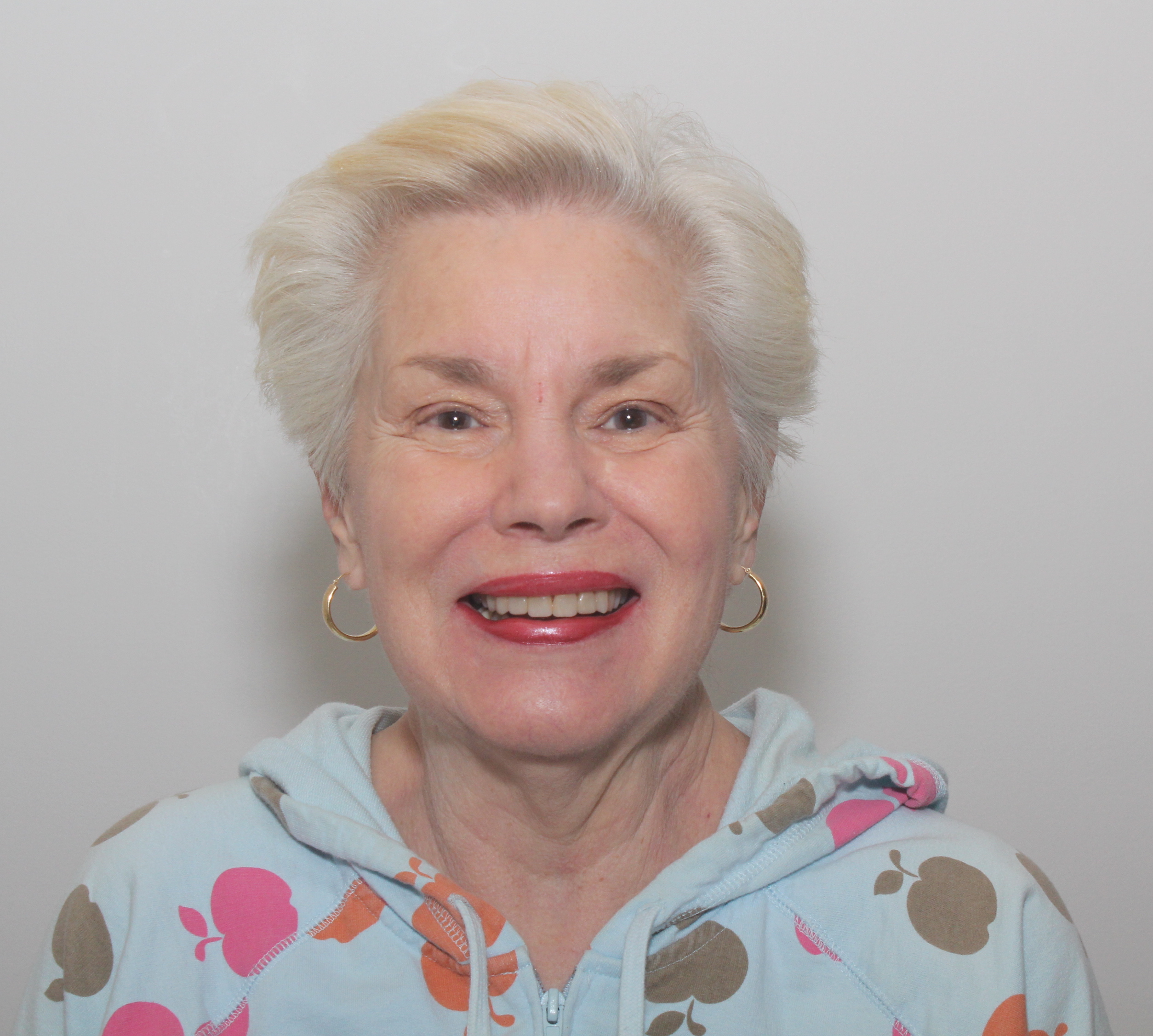 Digital face-bow transfer technique dentofacial analyser for dental ...